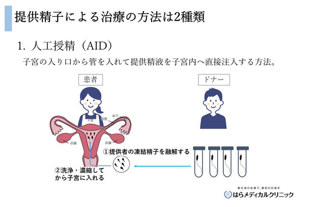 国内初*、精子バンク利用による 非配偶者間体外受精・顕微授精(IVF-D)を開始 | ニコニコニュース