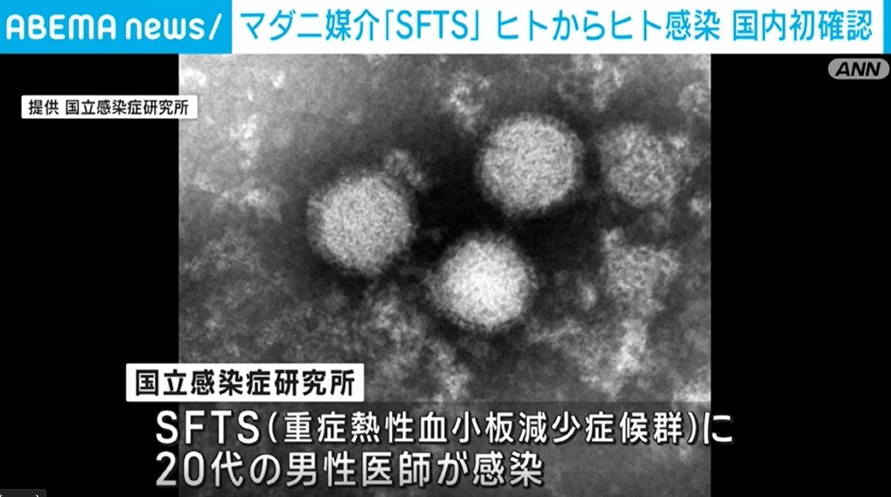 マダニ媒介「SFTS」 国内初 ヒトからヒトへの感染を確認 | ニコニコニュース