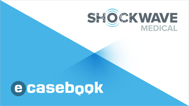 Shockwave Medical | ニコニコニュース