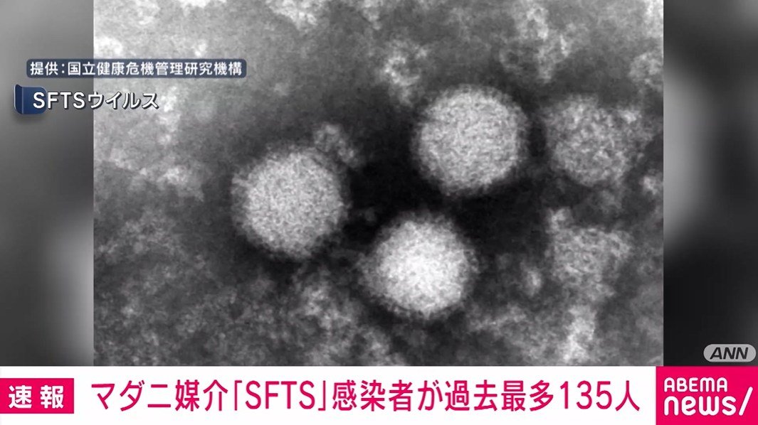 マダニ感染症「SFTS」全国感染者135人で過去最多更新 | ニコニコニュース